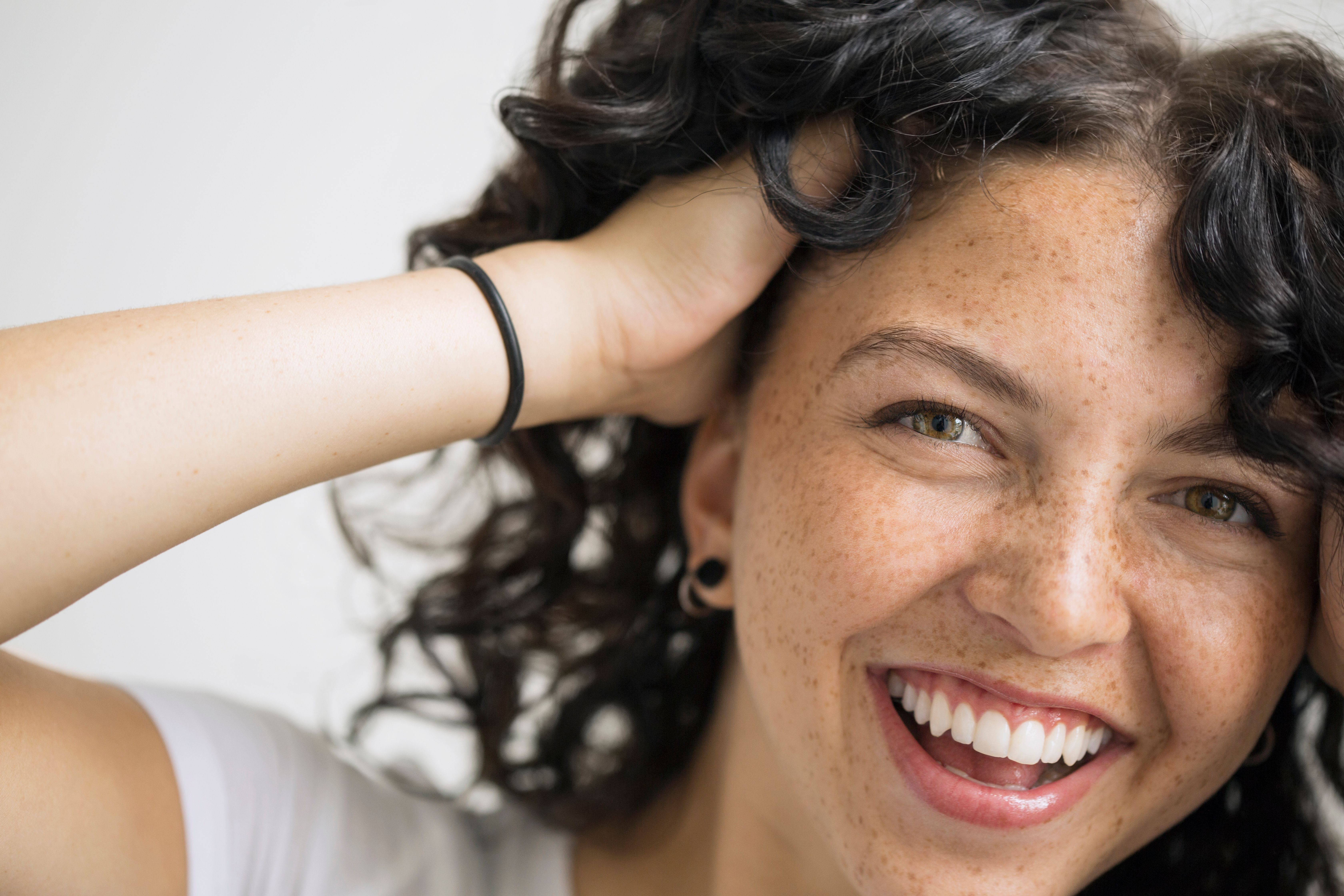 Freckles: What They Are, Freckles vs. Moles, Causes & Removal