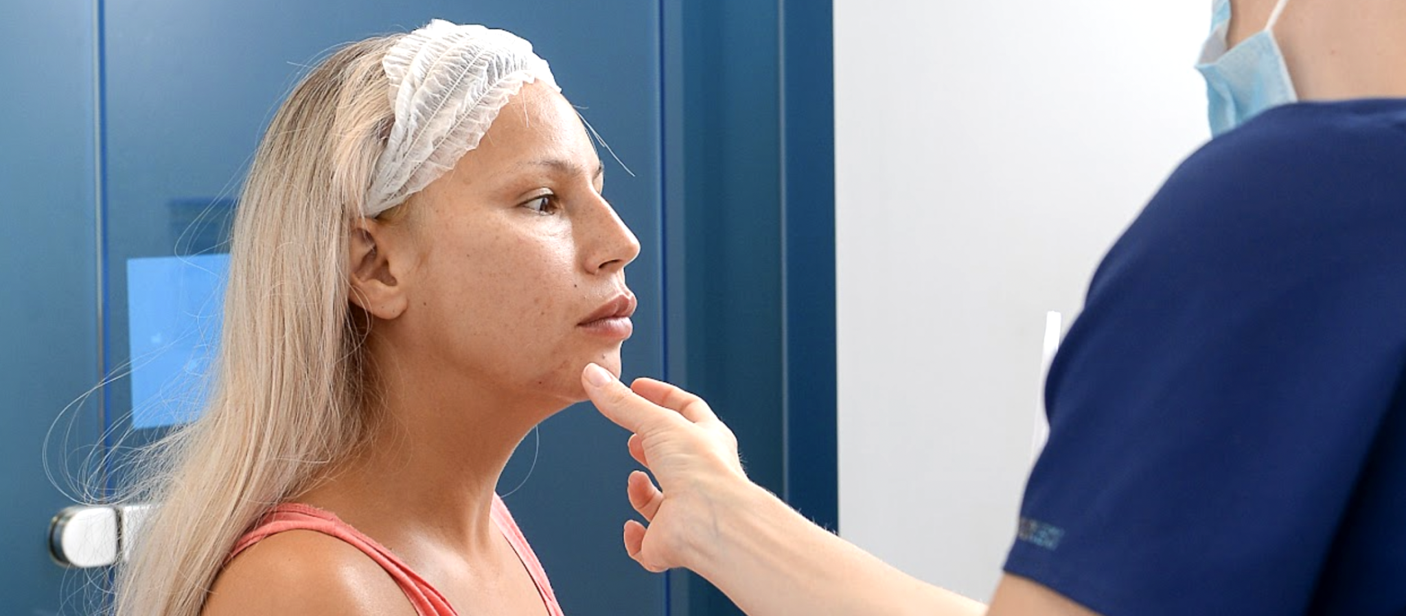 How to identify Lip Filler migration