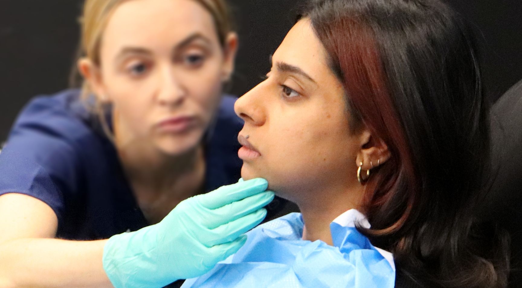 Chin Filler Technique: Lateral to Medial Approach