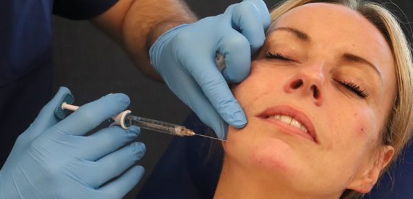 How to combine filler treatments for a liquid facelift