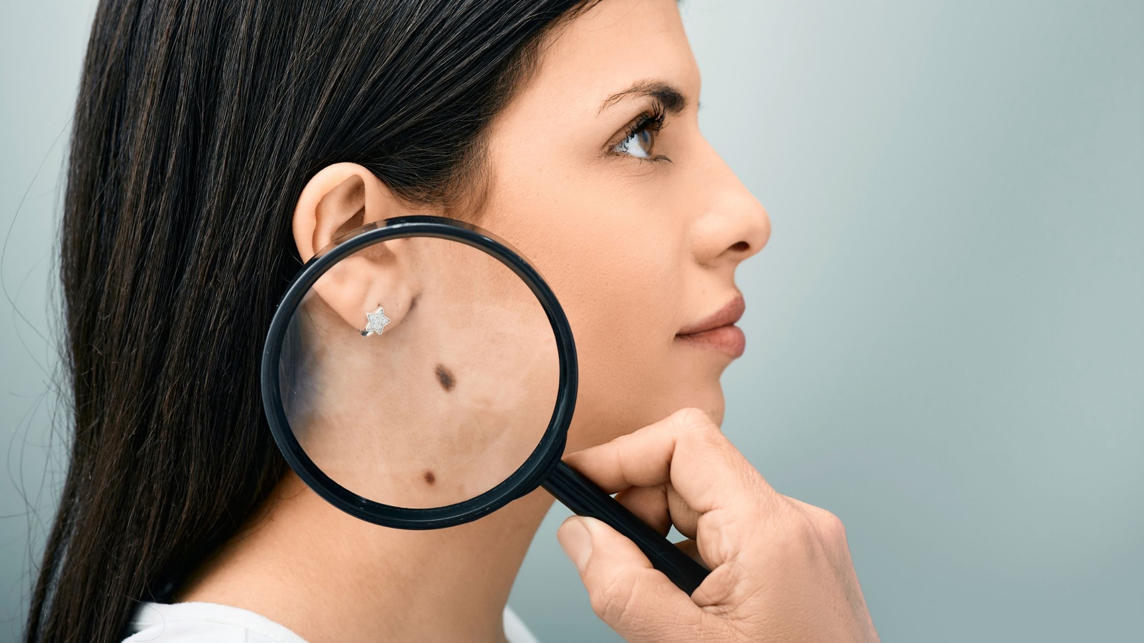 Mole Screening and Treatment: Early Detection and Preventive Care