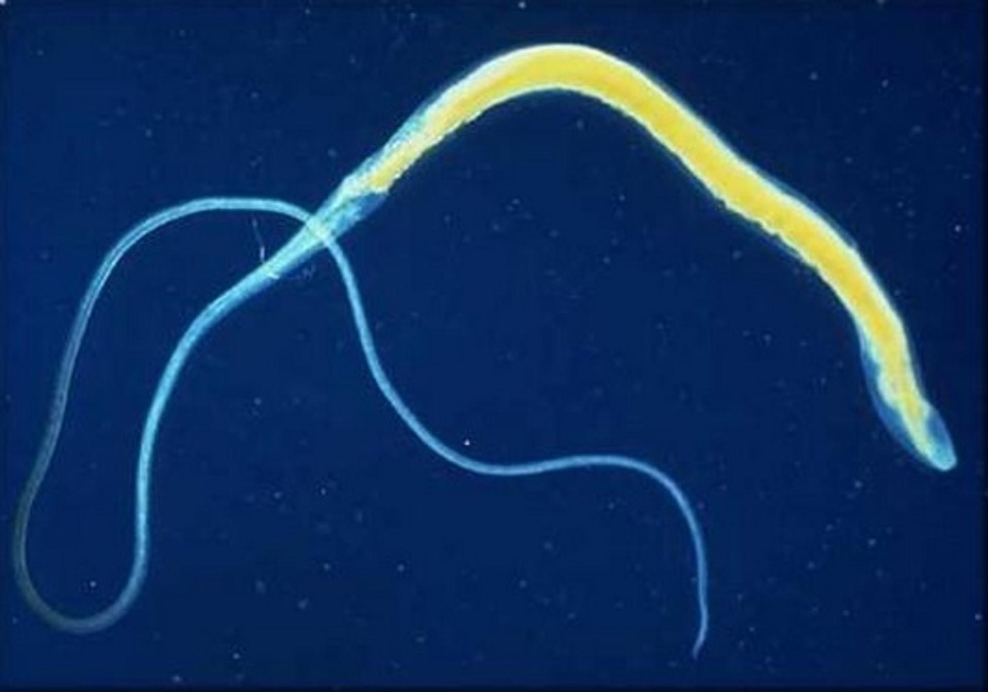 The evidence for deworming · Giving What We Can