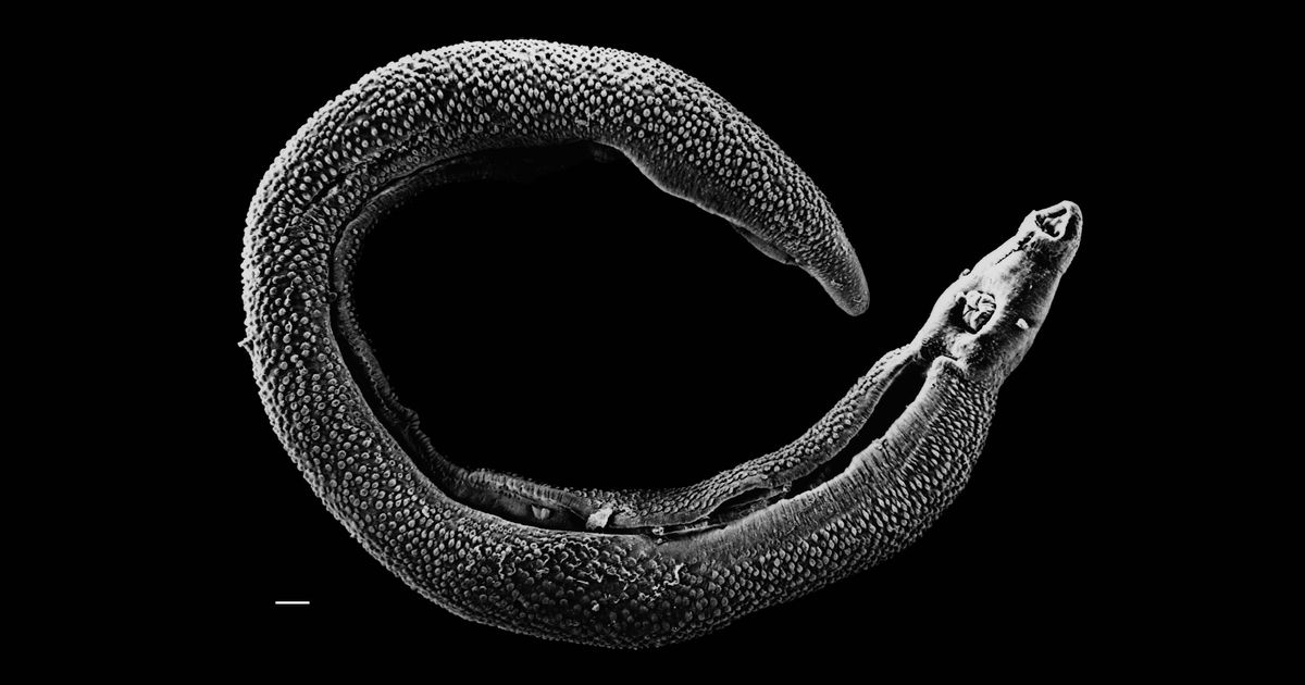 Parasitic Worms · Giving What We Can