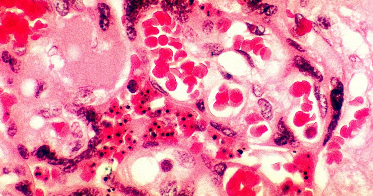 Malaria · Giving What We Can