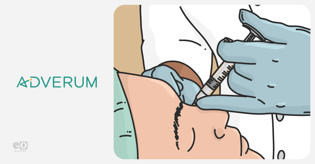 Adverum reports extended 4-year findings on wet AMD gene therapy