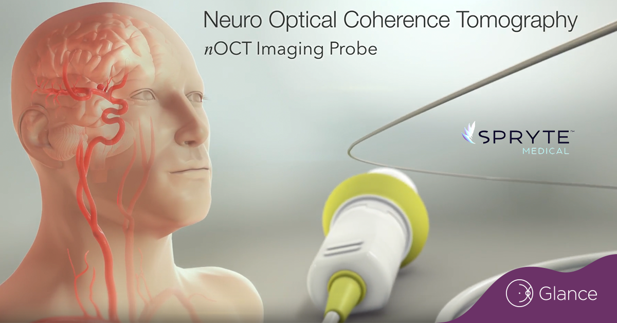 Spryte Medical earns FDA Breakthrough Device Designation for nOCT tech
