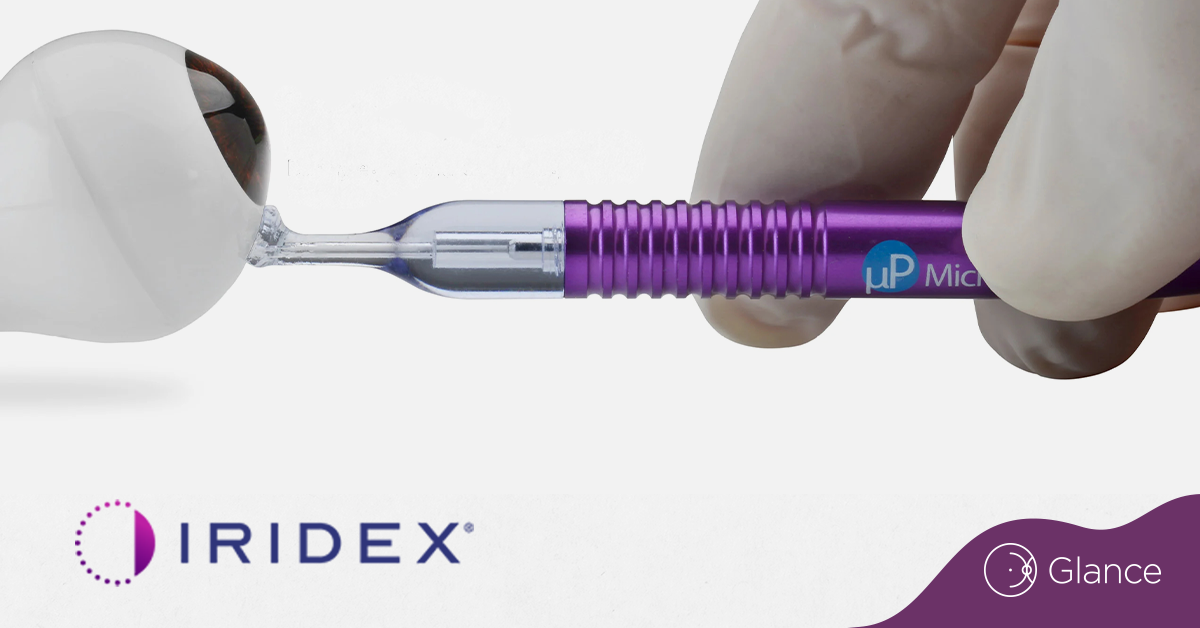 Iridex enrolls first patient in MicroPulse TLT glaucoma study