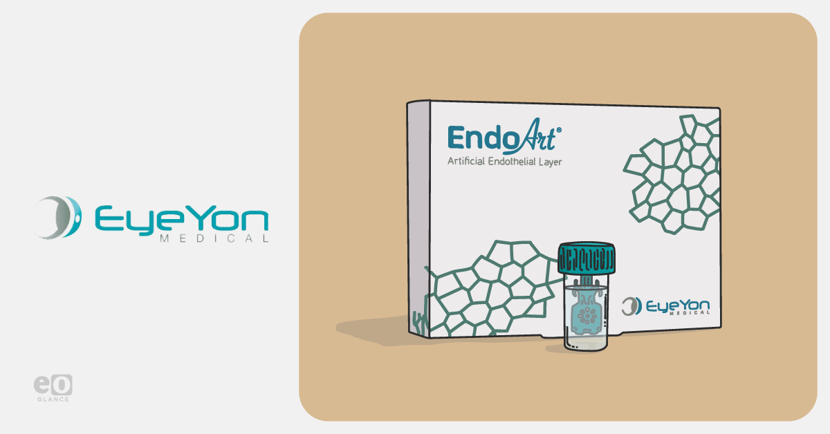 EyeYon Medical secures IDE approval for study on first artificial ...