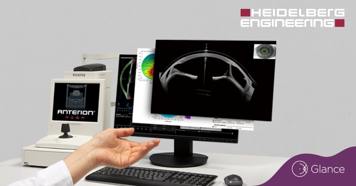 FDA clears Heidelberg Engineering's anterior segment diagnostics platform
