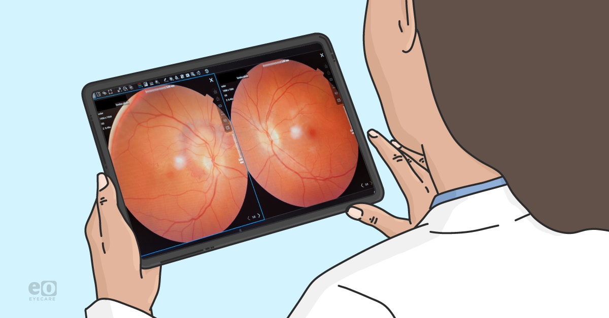 More Than Routine: Complex Cases Managed By Optometrists In National ...