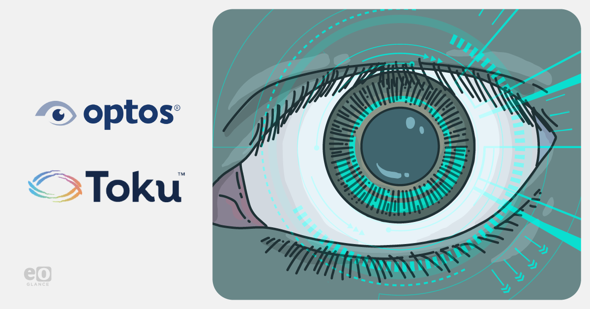 Optos and Toku partner to add AI-based 'BioAge' to UWF imaging