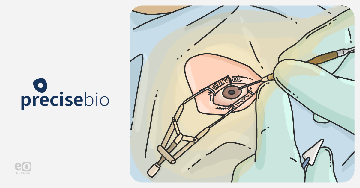 Precise Bio performs first transplant with 3D-printed cornea implant