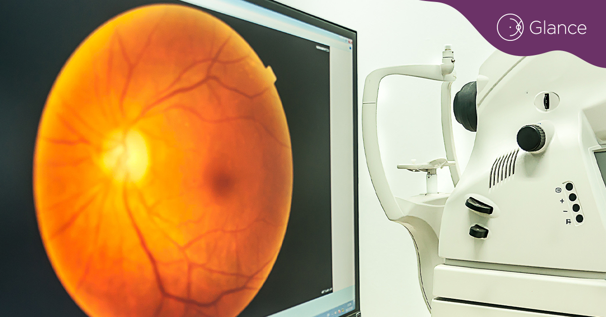 AI system detects severe ROP with 100% accuracy