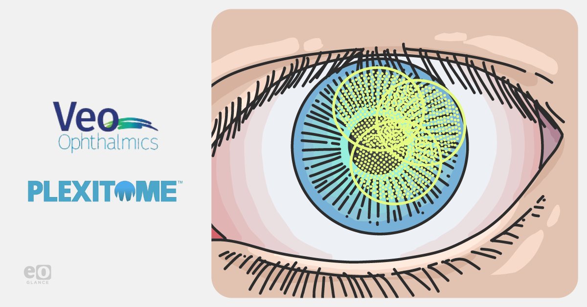 Unique anterior stromal puncture device targets RCEs