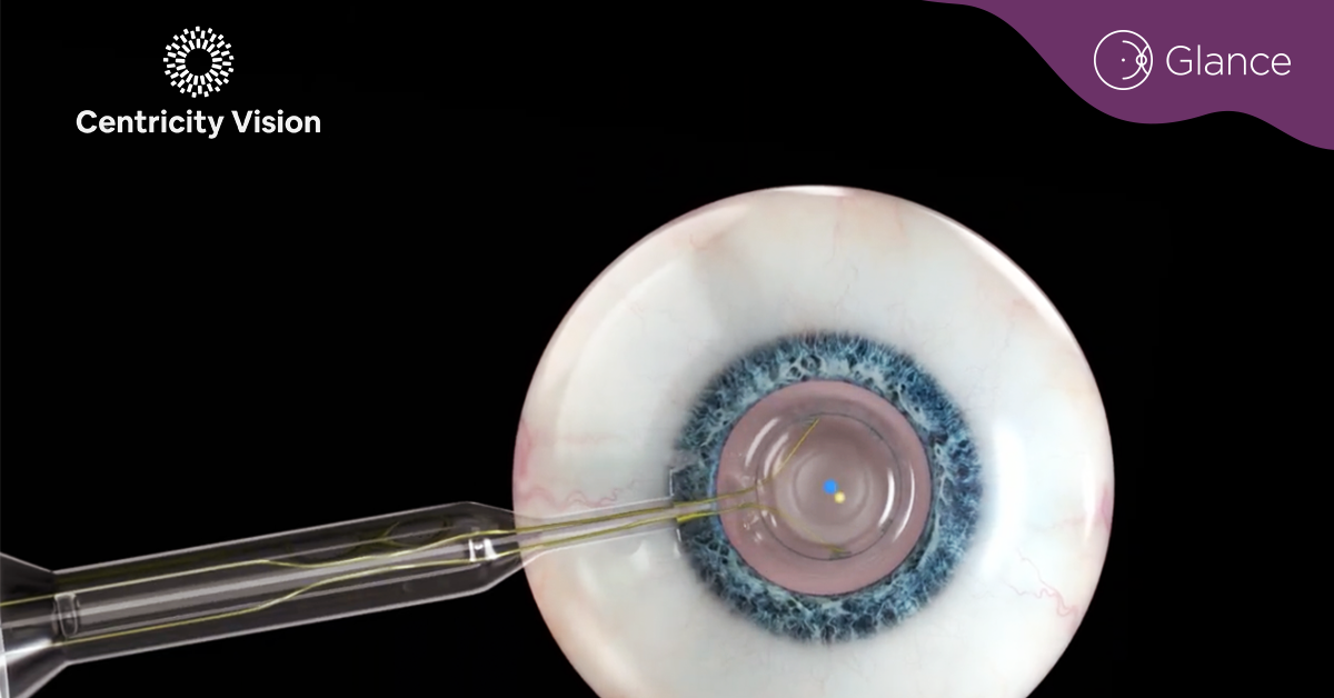 ZEPTOLink IOL Positioning System earns FDA clearance