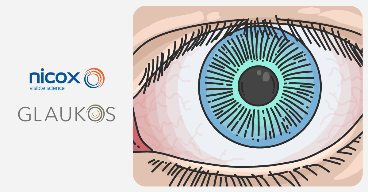Nicox and Glaukos sign global licensing option for glaucoma and retinal ...