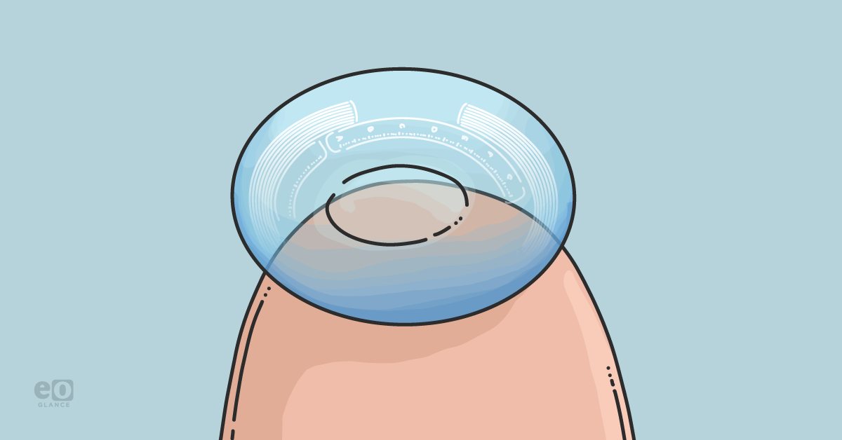 Smart contact lens performs real-time IOP monitoring