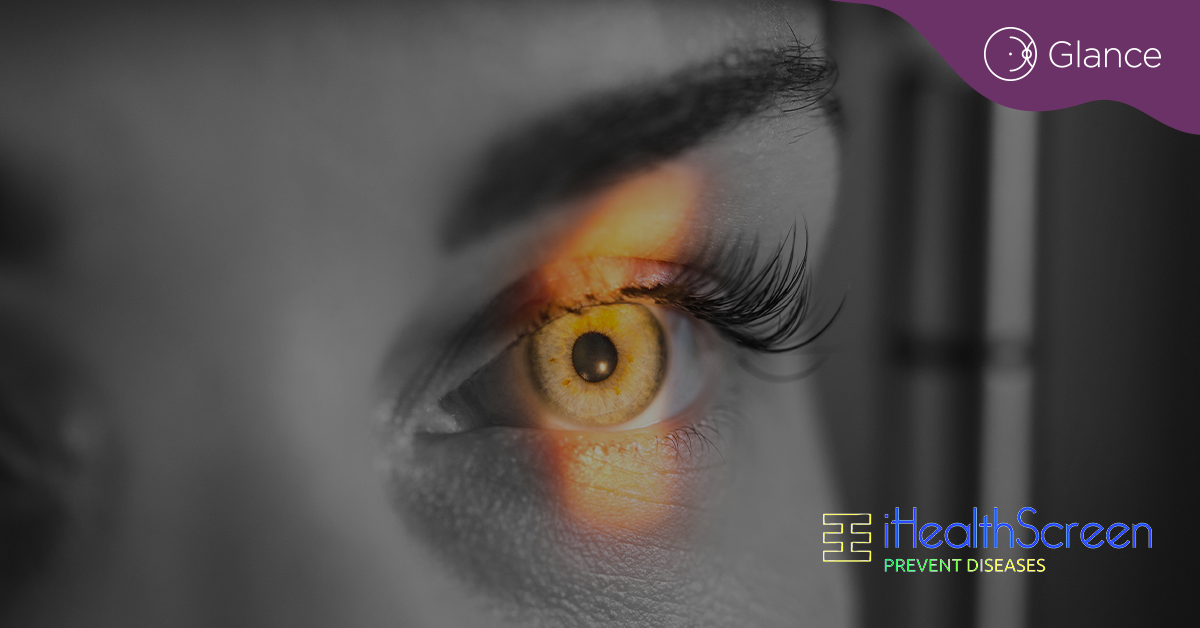 iHealthScreen receives US patent for iPredict glaucoma detection model