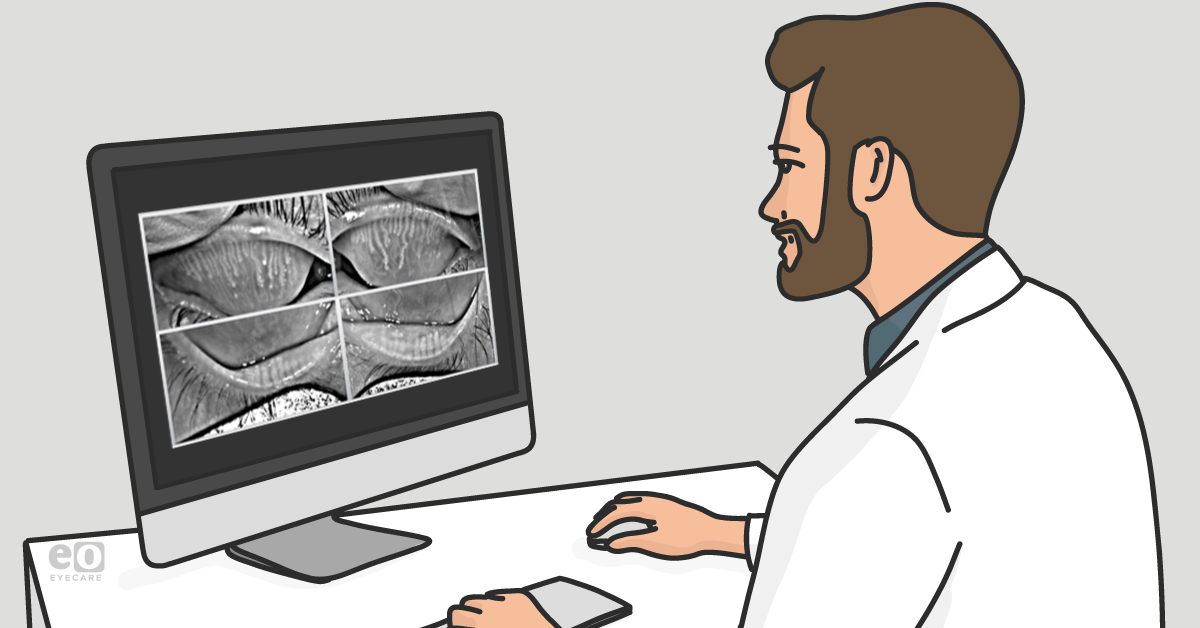 A Spectrum of Dysfunction: Differentiating the Types of Dry Eye