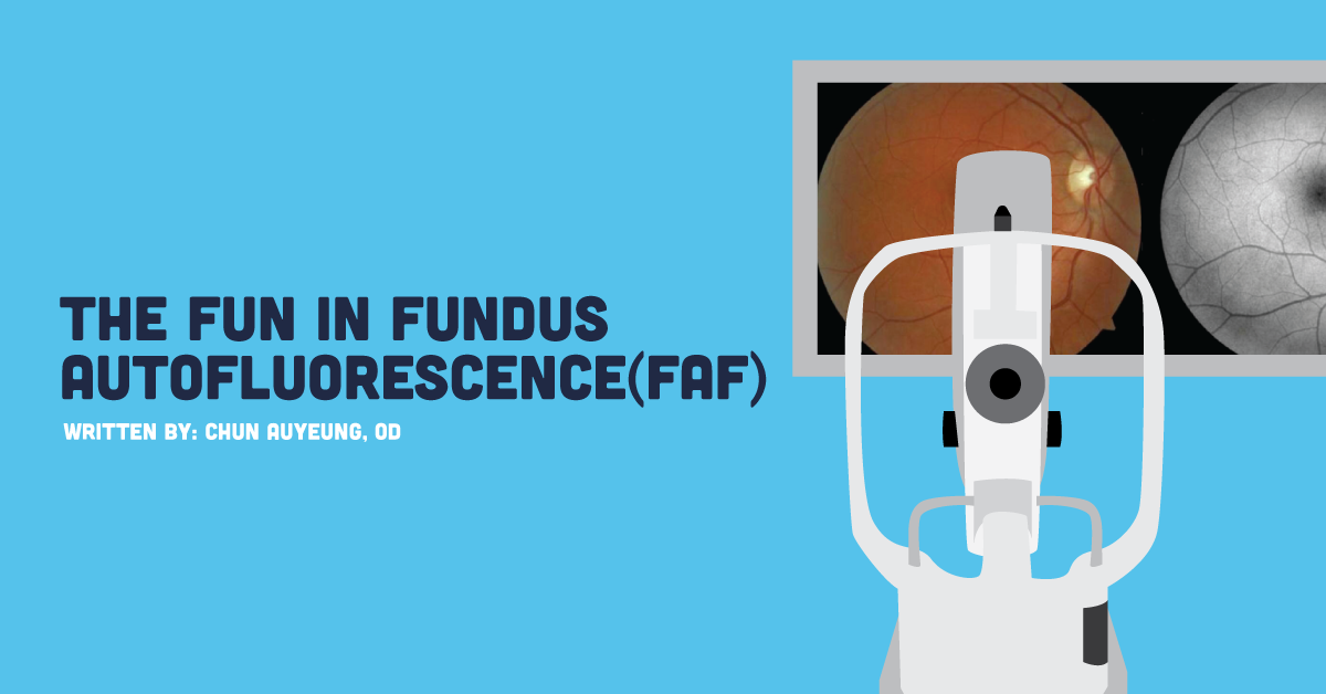 Putting The Fun In Fundus Autofluorescence (FAF)