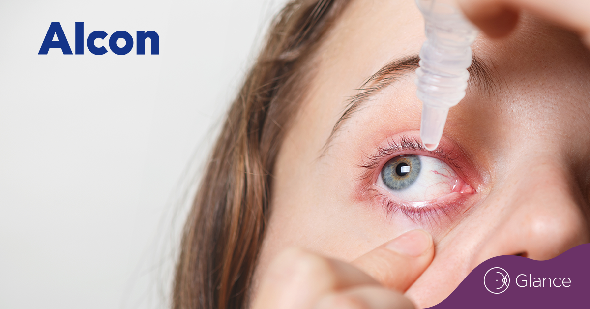 Positive topline data reported in Alcon's phase 3 COMET trials