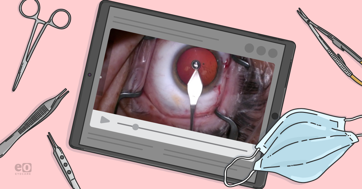 EVO ICL: Indications, Patient Selection, and Surgical Tips