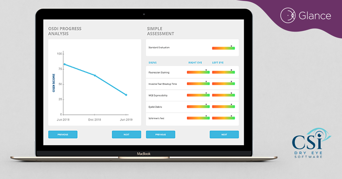 CSI Dry Eye Software releases new version of AI-based program