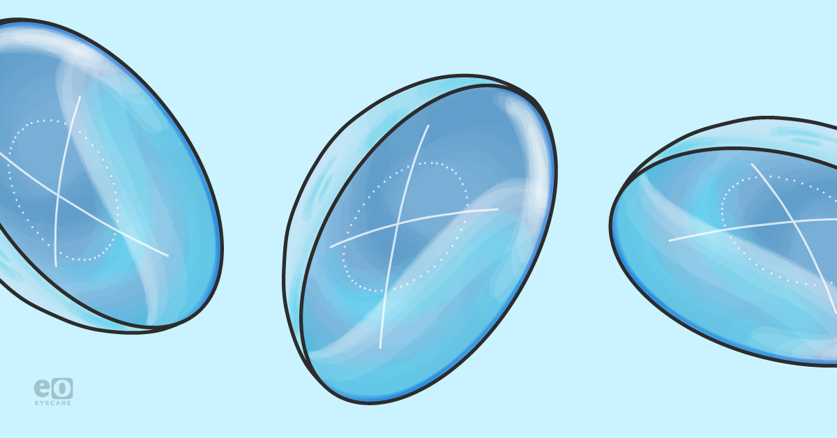 Keep Patients in the #1 Most Prescribed Toric Design, Migrate to MyDay ...