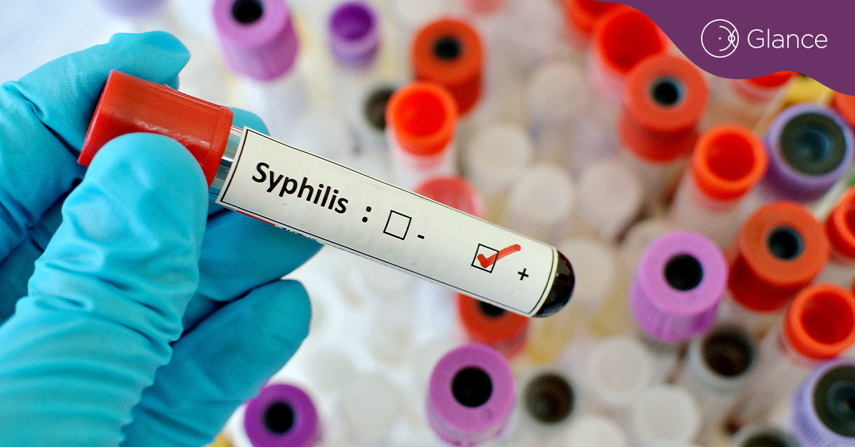 CDC reports rare cluster of ocular syphilis in the US
