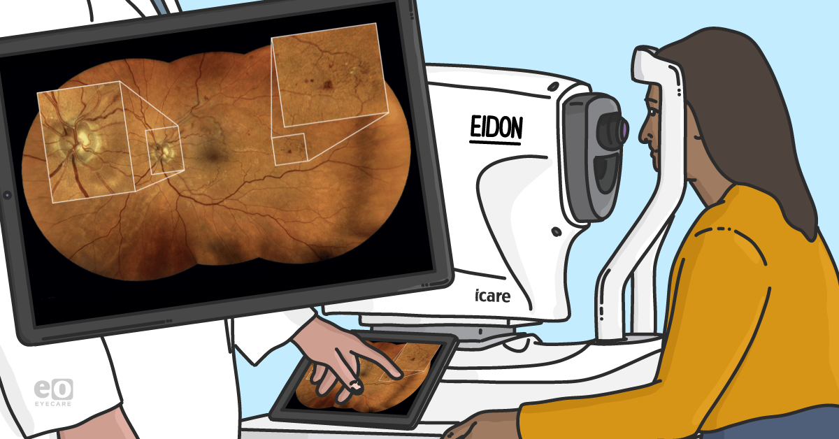 The Ultimate Guide to iCare Imaging and Perimetry