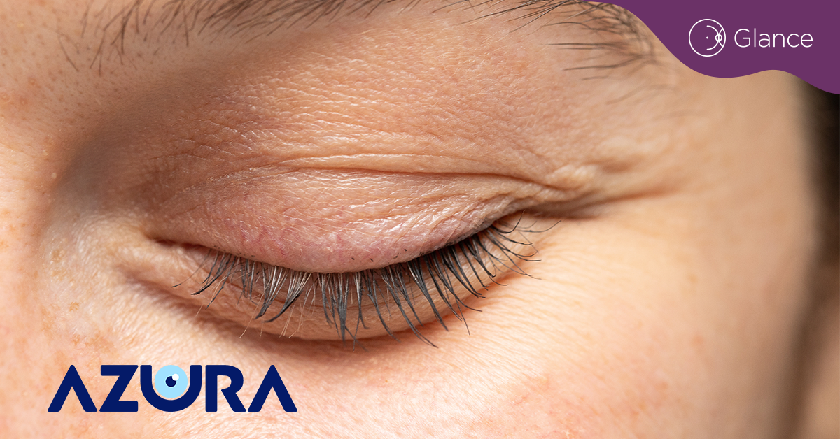 New 6-month data evaluates AZR-MD-001 for MGD