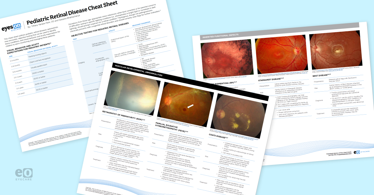 Managing Retinal Disease in Pediatric Patients with Cheat Sheet