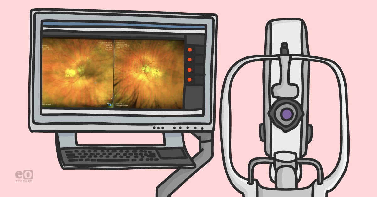 How Ultra-Widefield Imaging Can Boost Your Practice and Benefit Your ...
