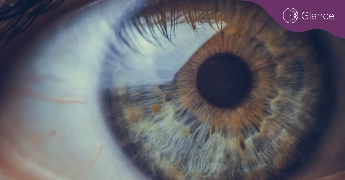 Identifying the link between pupil response and depression