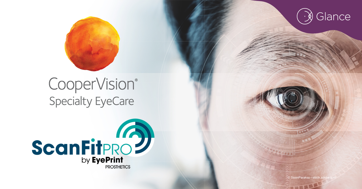 CooperVision now sole provider of SynergEyes’ scleral lens design system