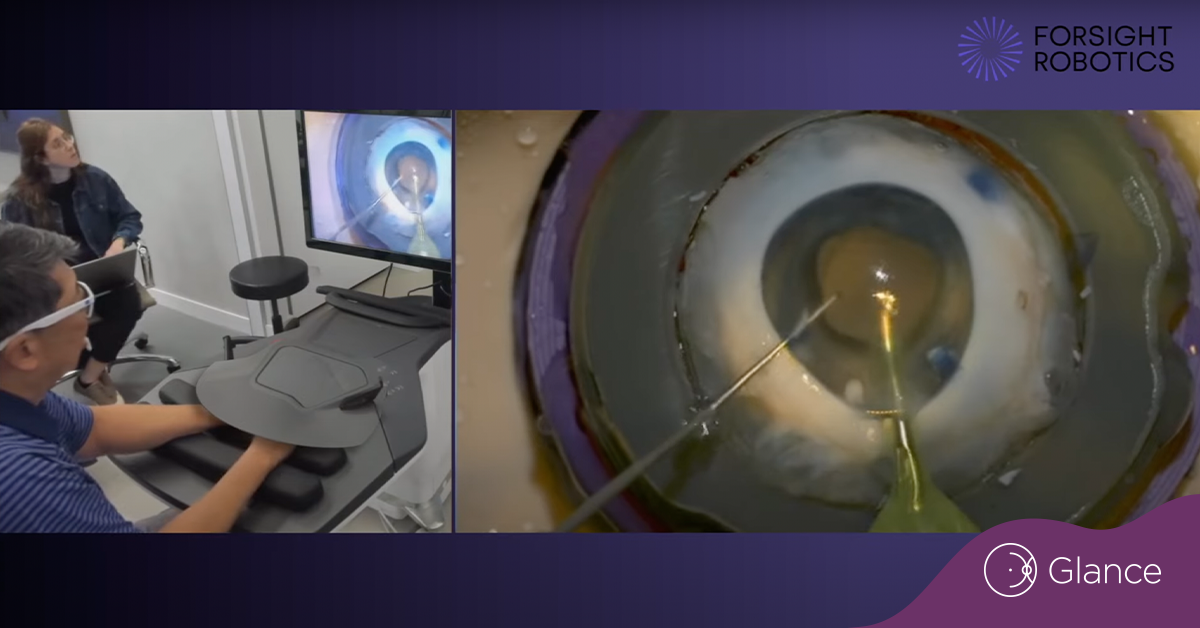 First-of-its-kind robotic cataract procedure makes debut at ASCRS