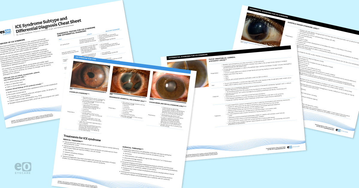 ICE, ICE Baby: Iridocorneal Endothelial Syndrome and Secondary Glaucoma