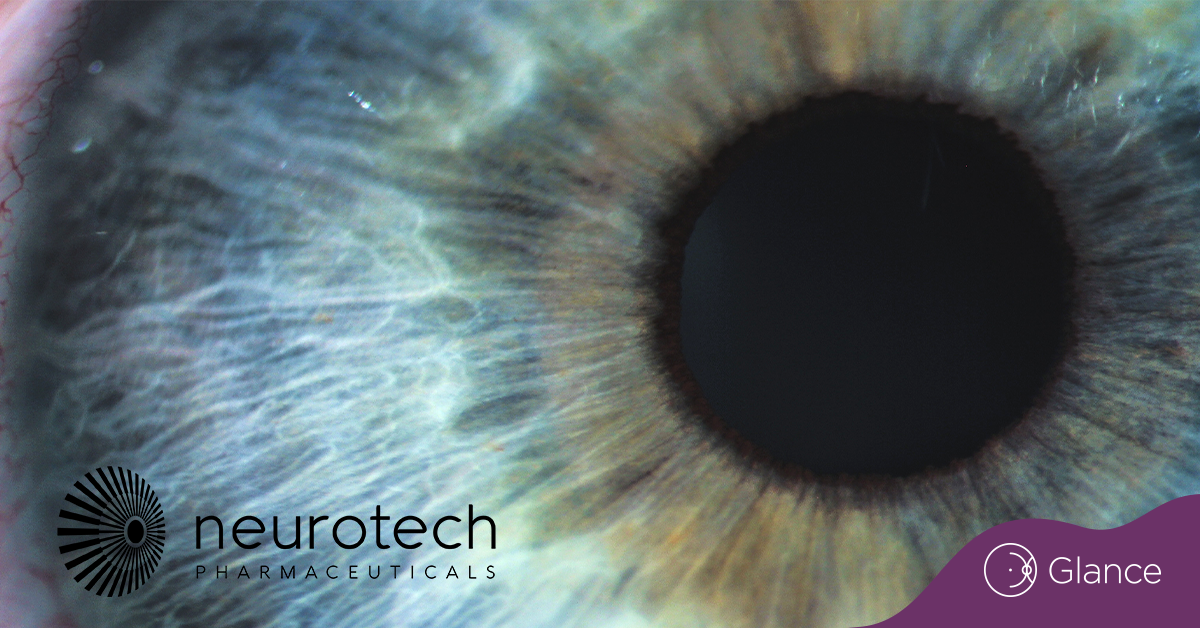 Neurotech Pharma earns BLA priority review for MacTel cell therapy