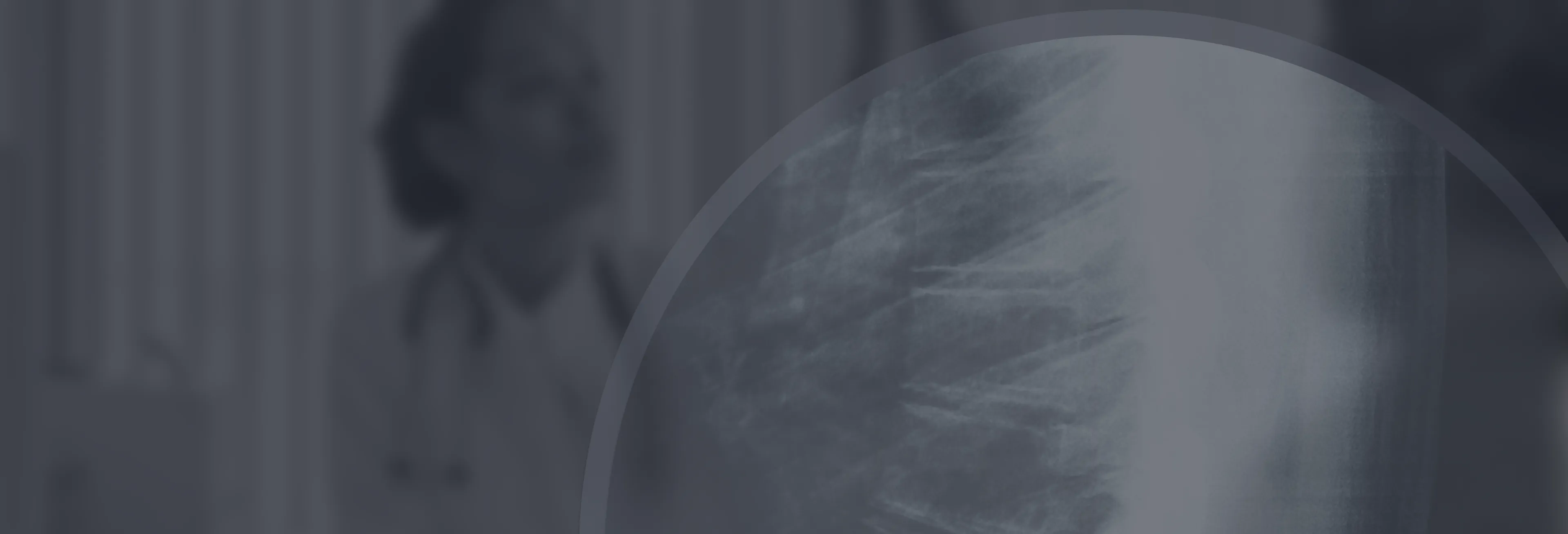 Lumbar Laminectomy with Fusion | Riverside, CA