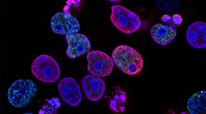 How Do You Get Cancer? | OneVillage