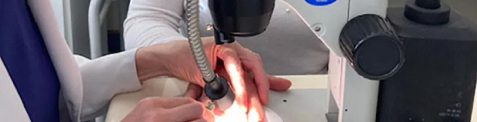 Como Eu Utilizo a Capilaroscopia Periungueal