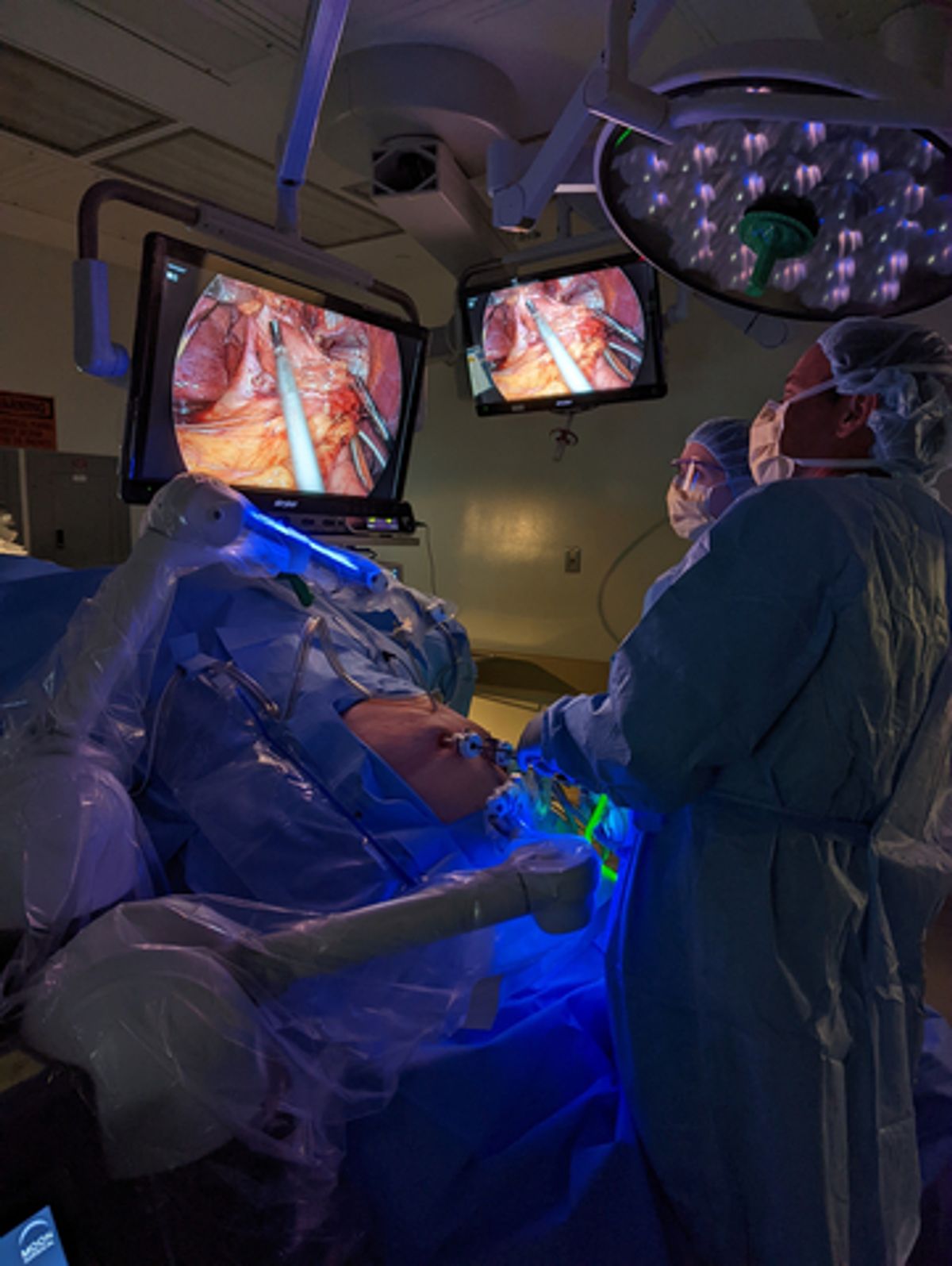 Moon Surgical announces first clinical cases in the U.S. using Maestro ...