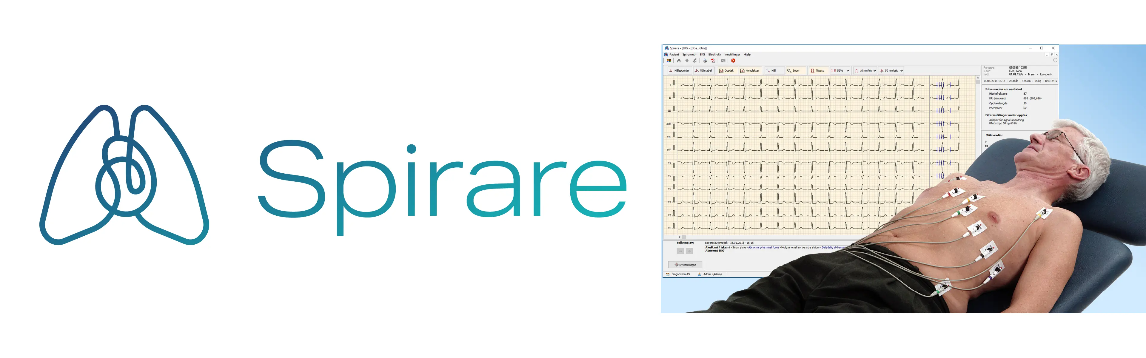 Spirare fra Norengros Helseservice | Norengros