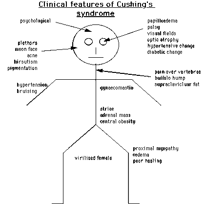 Summary of the clinical features of Cushing's syndrome – GPnotebook