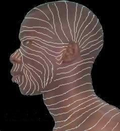 Wrinkle lines as described by Kraissl – Primary Care Notebook