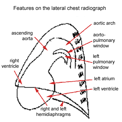 Diagram of the lateral chest radiograph – GPnotebook