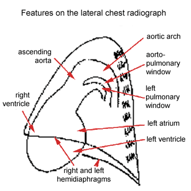 Diagram of the lateral chest radiograph – GPnotebook