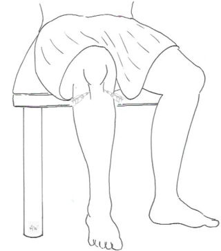 Anterior approach - aspiration or injection of the knee joint – GPnotebook