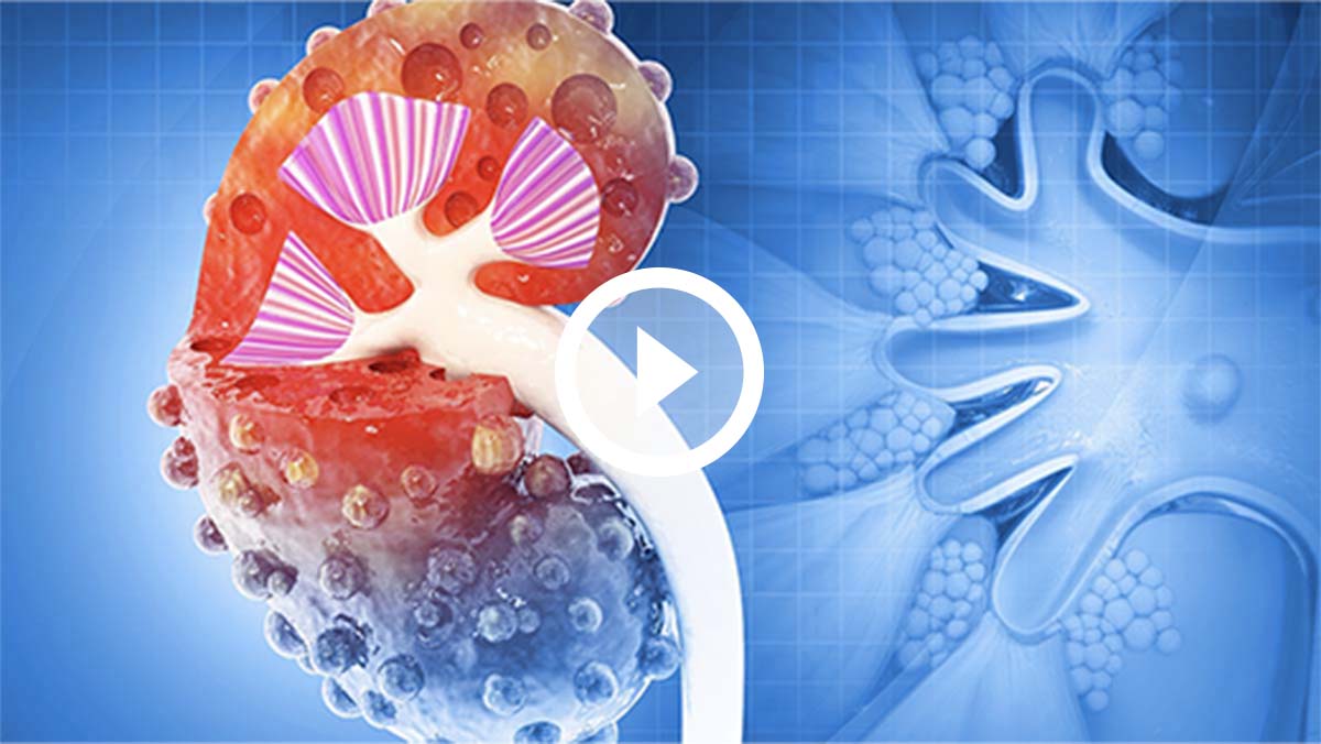 Ep 163 – Chronic kidney disease among adults in primary care: testing ...
