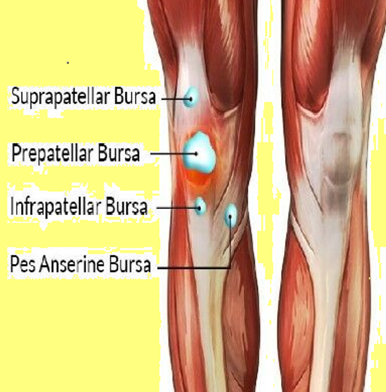 Pes anserine bursitis – GPnotebook